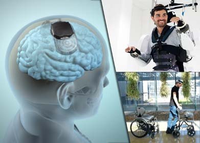 WIMAGINE, un implant pour retrouver de l’autonomie, une innovation ...